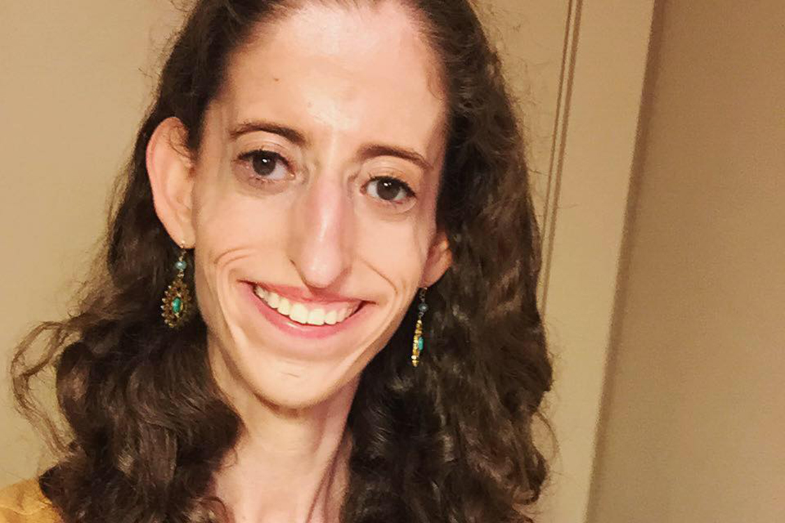 Mulher que quase nunca tem fome pode ajudar na cura da obesidade | VEJA