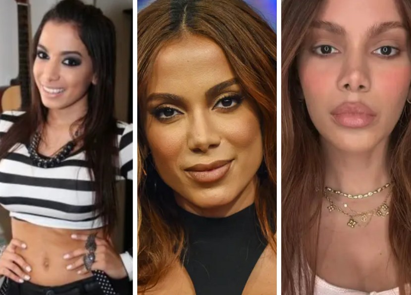O que há de fato por trás das mudanças no visual de Anitta | VEJA